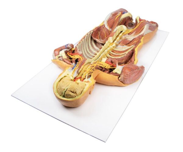 Posterior Body Wall / Ventral Deep Dissection - Australian ...