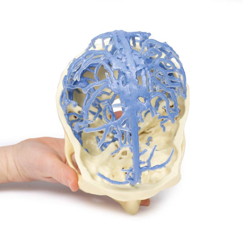 3D Printed Anatomy - Venous Circulation - Australian Physiotherapy ...