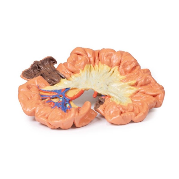 Bowel - Portion of Ileum - Australian Physiotherapy Equipment