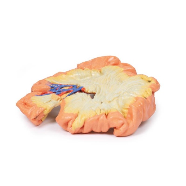 Bowel - Portion of Jejenum - Australian Physiotherapy Equipment