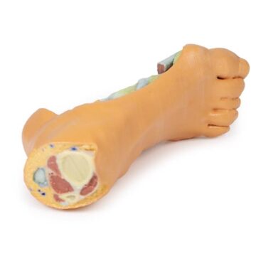 Foot - Deep plantar structures - Australian Physiotherapy Equipment