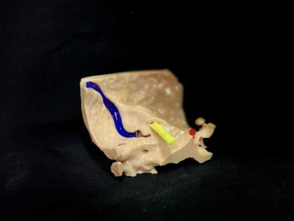 Petrous Bone Simulator - Australian Physiotherapy Equipment