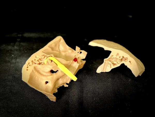 Petrous Bone Simulator - Australian Physiotherapy Equipment