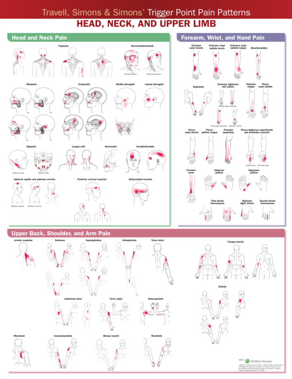 Travell, Simons & Simons’ Trigger Point Pain Patterns Wall Chart: Head ...