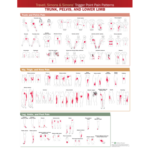 Travell, Simons & Simons’ Trigger Point Pain Patterns Wall Chart: Trunk ...