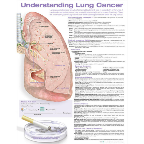 Understanding Lung Cancer Anatomical Chart - Soft Laminate - Australian ...
