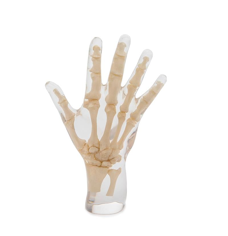 X-Ray Phantom Hand, transparent - Australian Physiotherapy Equipment