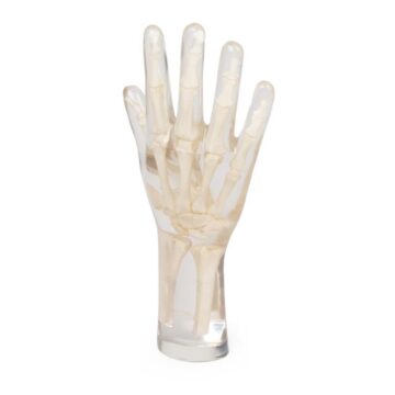 X-Ray Phantom Hand, transparent - Australian Physiotherapy Equipment