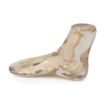 X-Ray Phantom Foot, transparent - Australian Physiotherapy Equipment