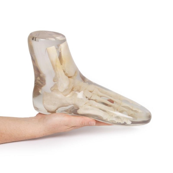 X-Ray Phantom Foot, transparent - Australian Physiotherapy Equipment