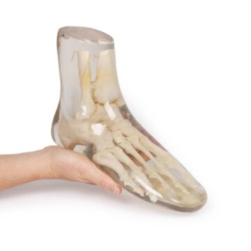 X-Ray Phantom Foot, transparent - Australian Physiotherapy Equipment