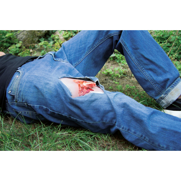 Wound Moulage Open Fracture, Leg with Bleeding Function - Australian ...